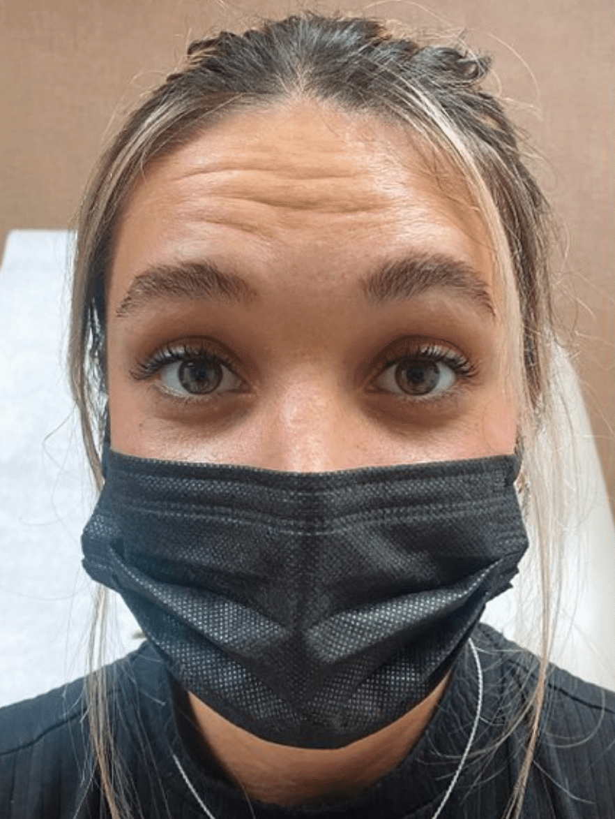 Non-Surgical Archives - Miami Plastic Surgery